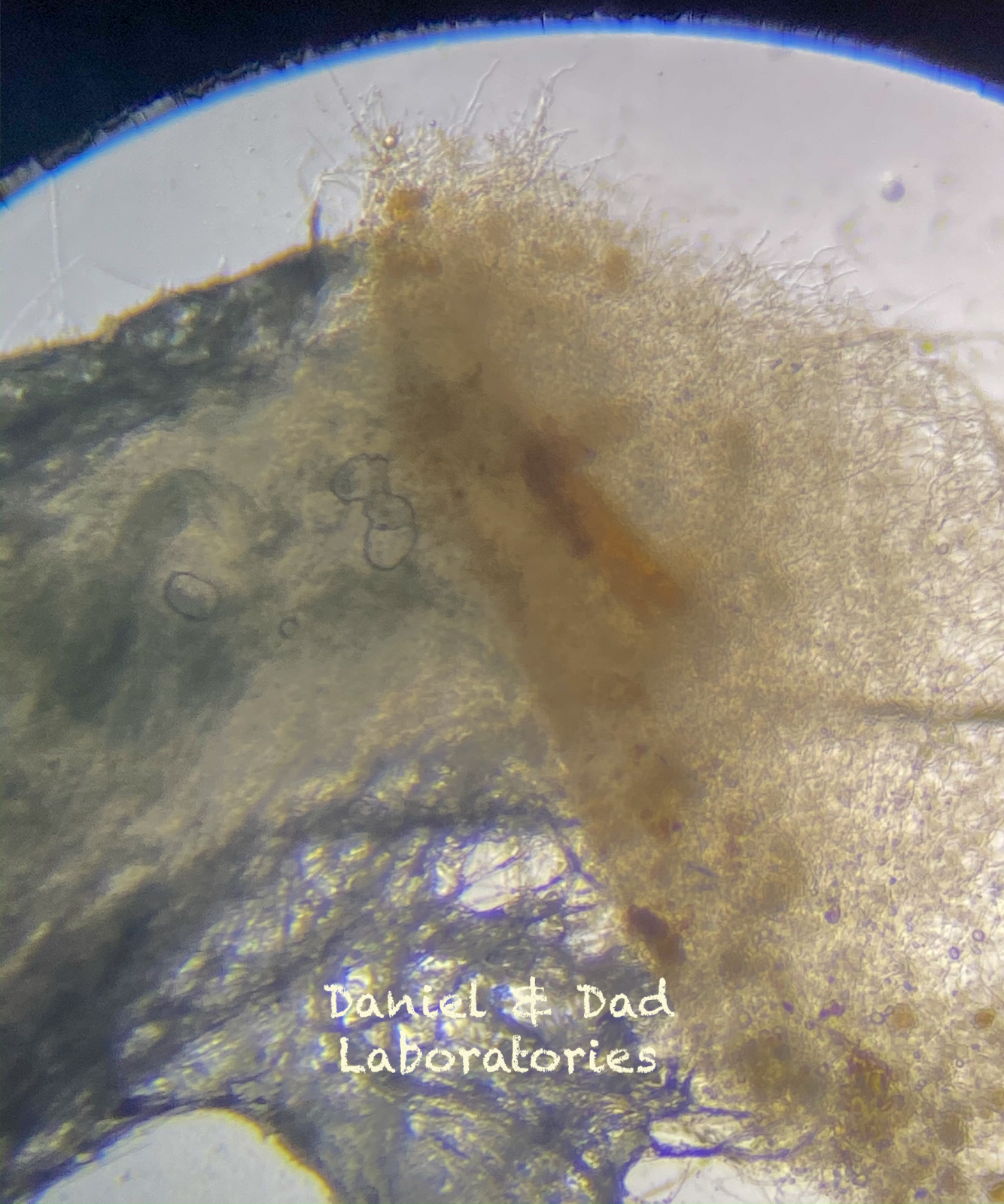 Microscopic World of Mold – Daniel & Dad Laboratories